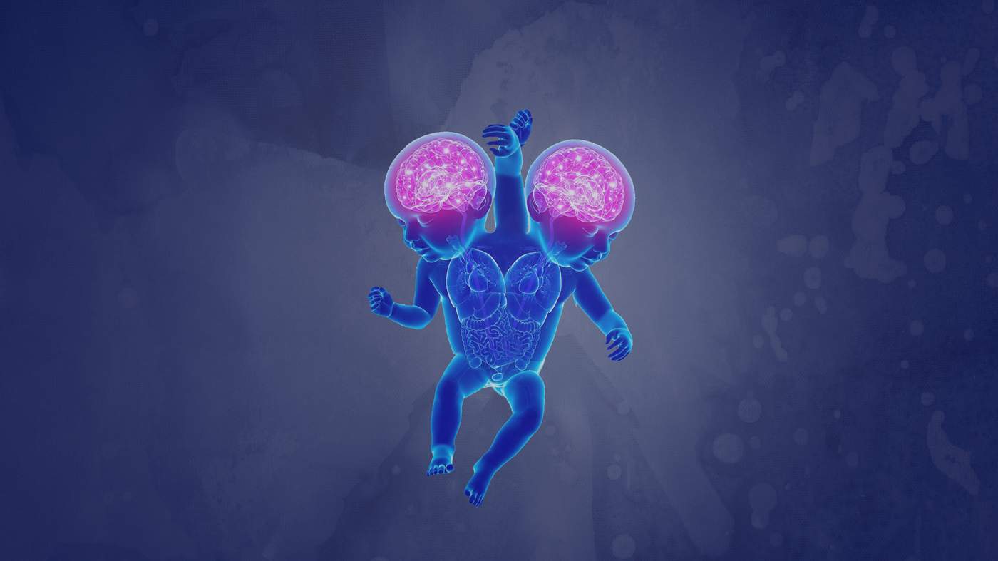 Two girls, one body - BBC News